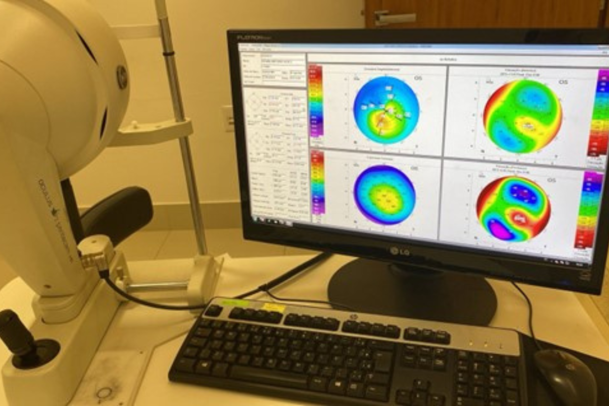 Pentacam – Tomografia de Córnea - Instituto São Lucas